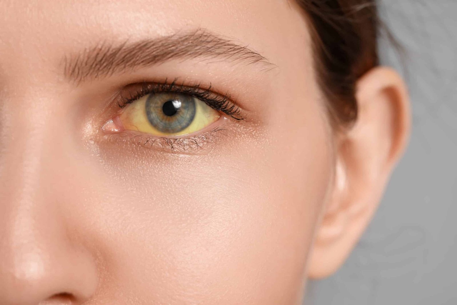 If Your Skin Turns Yellow as You Age, Don’t Ignore It – It May Signal ...